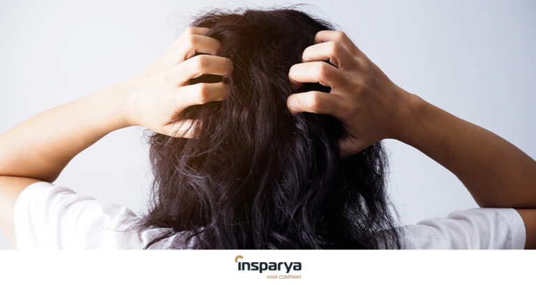 Hongos en la cabeza o en el pelo - Tipos - ¿Cómo eliminar?